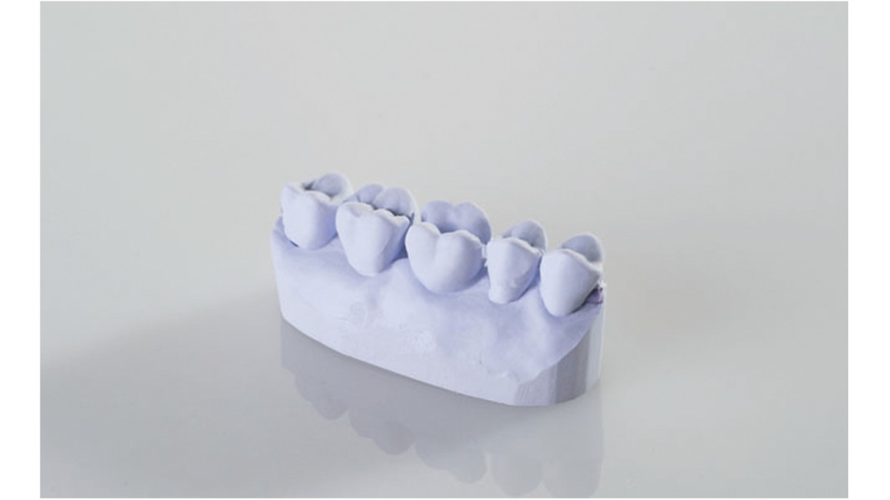 Flexitime Bite – modern bite registration