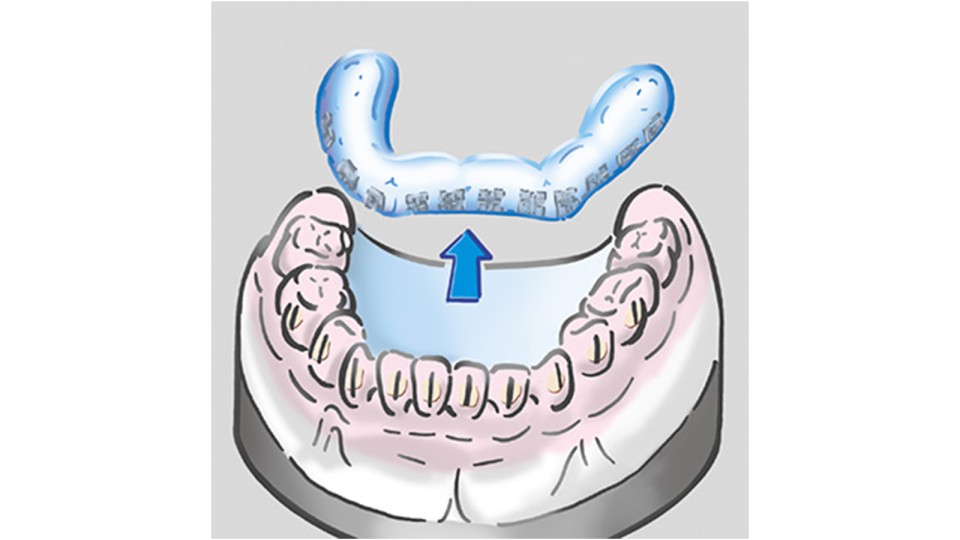MEMOSIL 2 - the expert for special indications