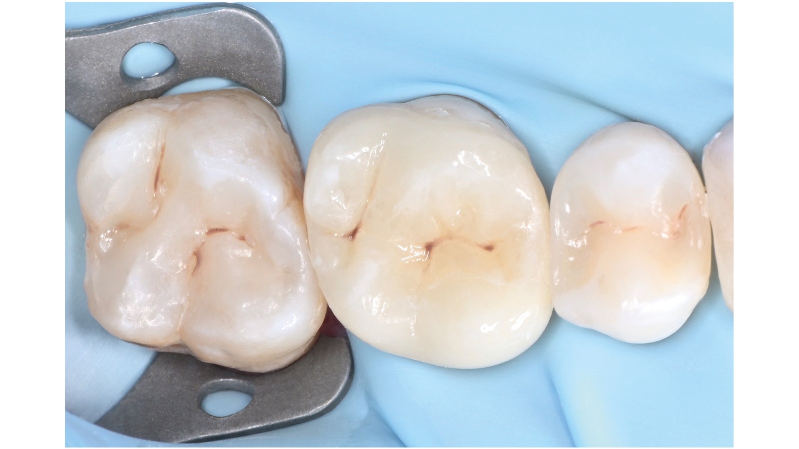 Venus ONE. Always the right shade!