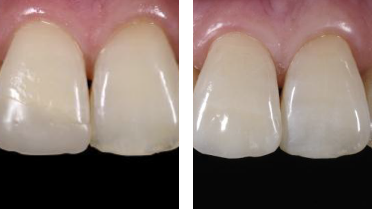 Venus® Pearl Art Shades