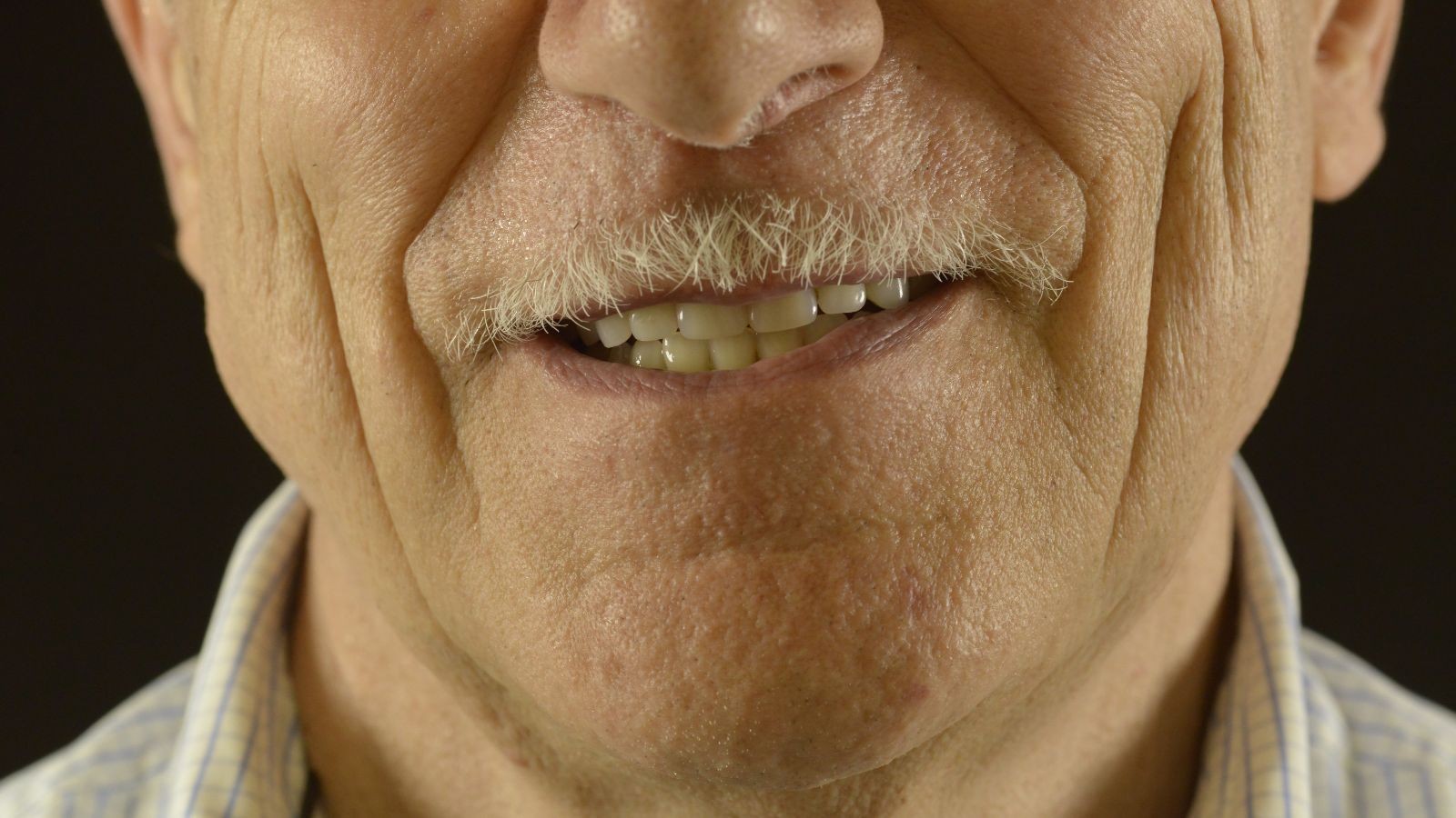 CASO CLINICO: I mezzi per il successo