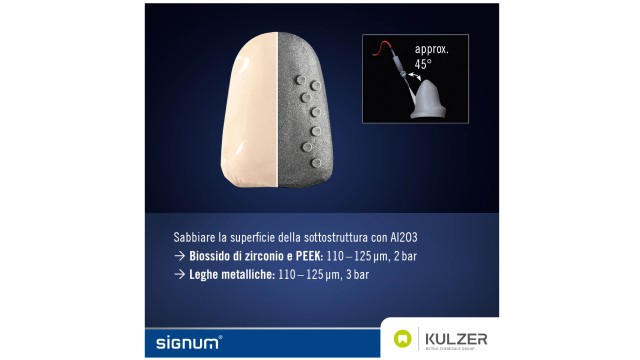 Signum® universal bond